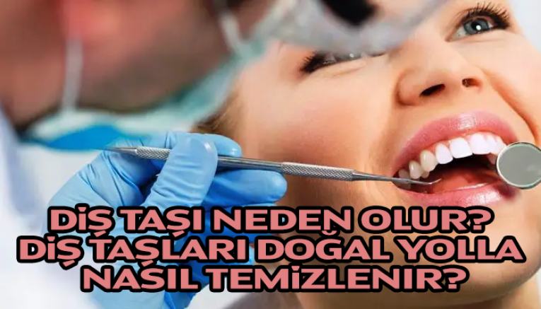Diş Taşı Neden Olur? Diş Taşları Doğal Yolla Nasıl Temizlenir? - SAĞLIK ...